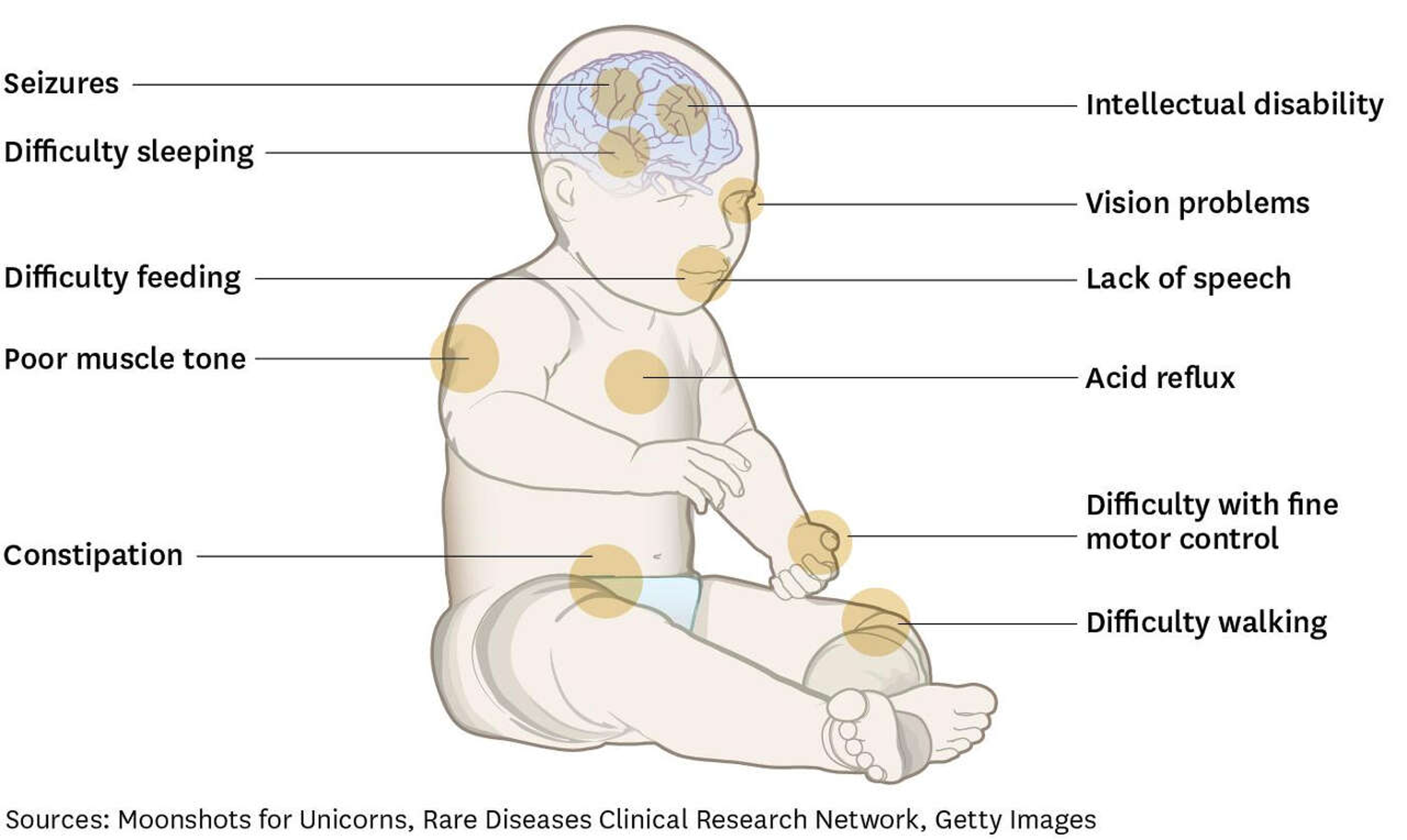 What is a Rare Genetic Disorder?